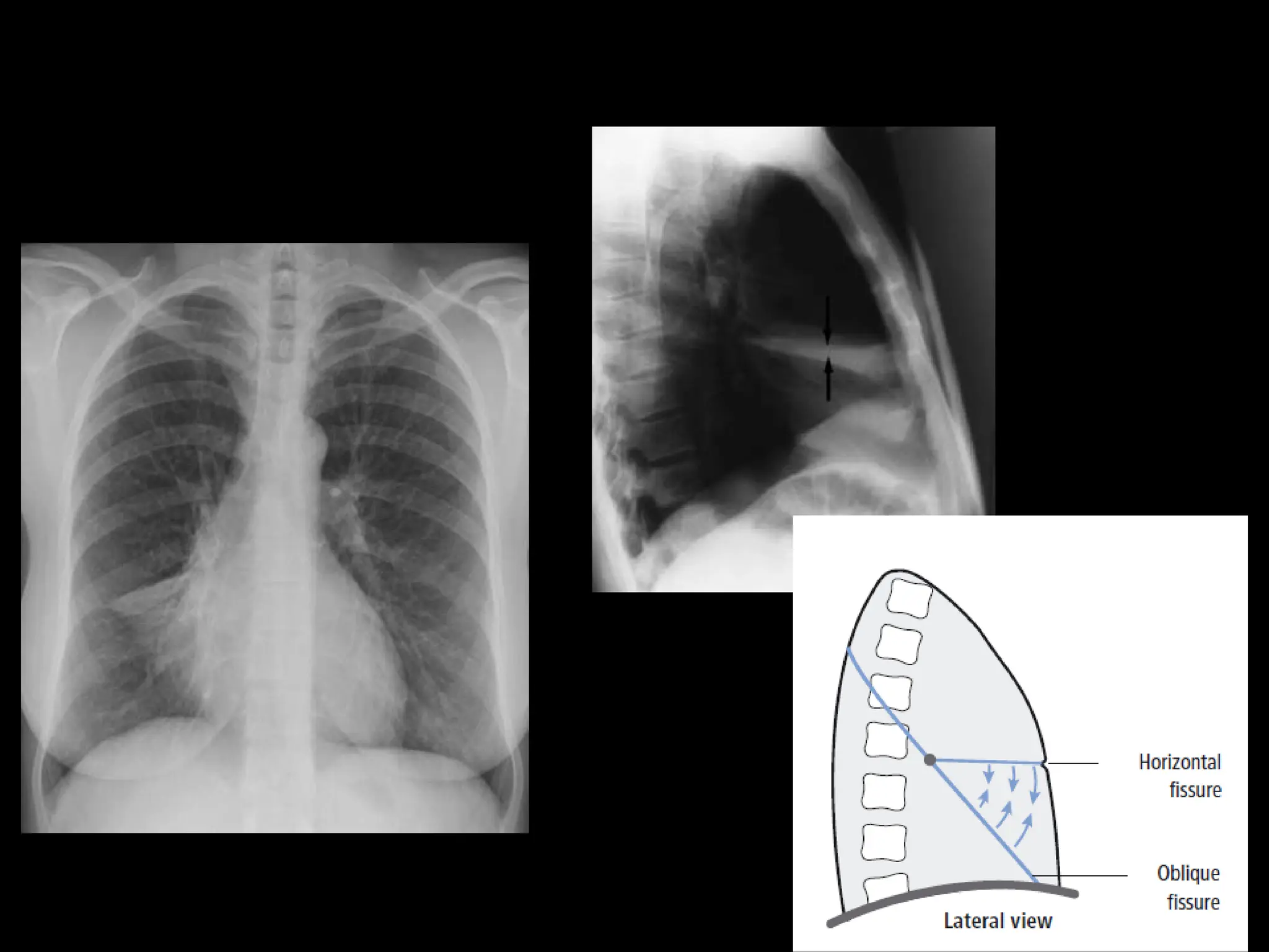 7. INTERPRETATION OF THE ABNORMAL FILM.pptx