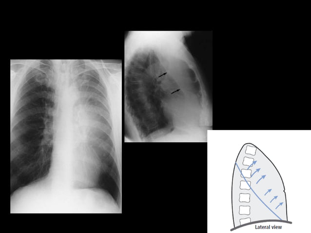 7. INTERPRETATION OF THE ABNORMAL FILM.pptx