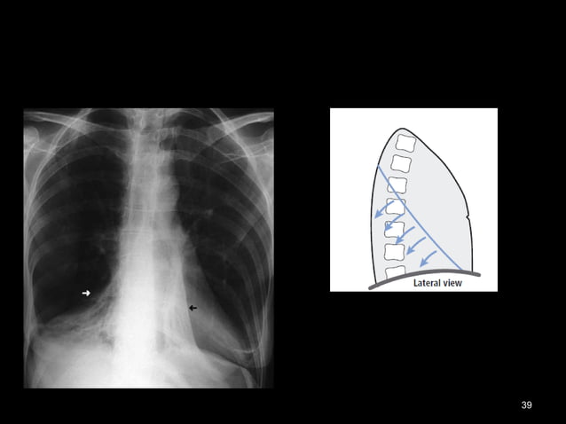 7. INTERPRETATION OF THE ABNORMAL FILM.pptx