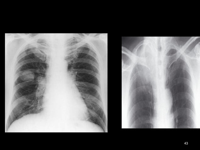 7. INTERPRETATION OF THE ABNORMAL FILM.pptx