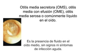 Patología oído medio otorrinolaringología | PPTX