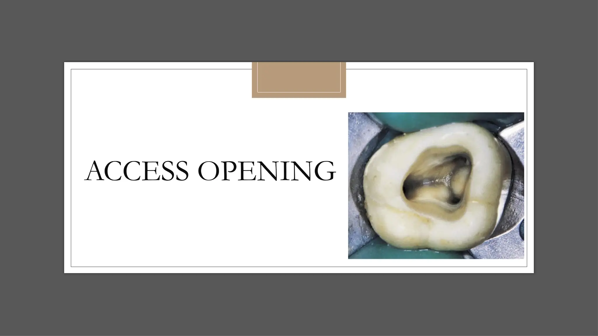 7. ENDODONTIC INSTRUMENTS in endodontics.pptx