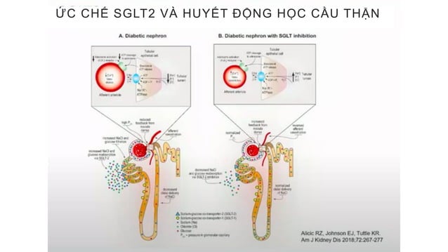 7. KDIGO guideline Benh than man 2023 pdf | PDF