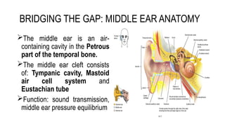 7.MIDDLE EAR EFFUSION.pptxbBhhbbhjnakahva | PPTX