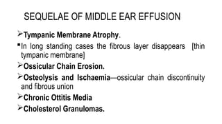 7.MIDDLE EAR EFFUSION.pptxbBhhbbhjnakahva | PPTX