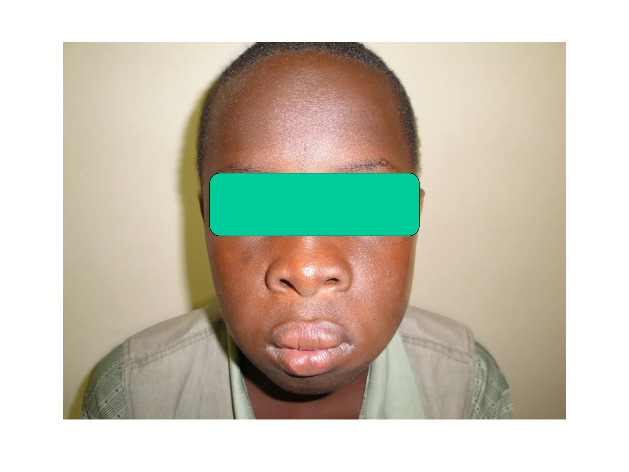 7.lect.Intro to comm skin dis 2021.pptx