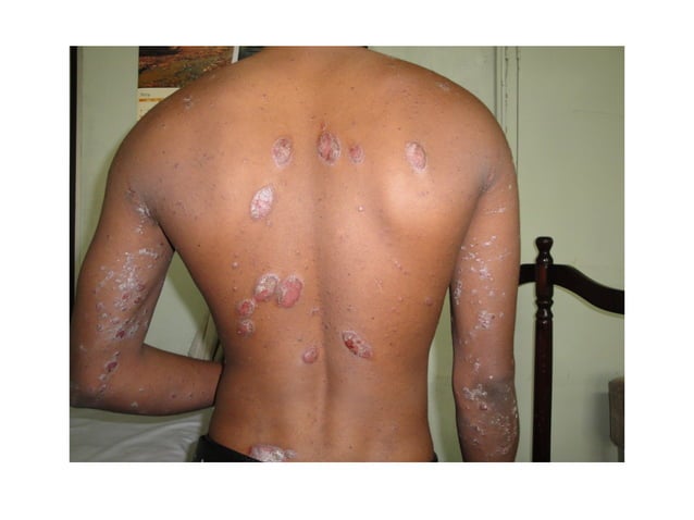 7.lect.Intro to comm skin dis 2021.pptx