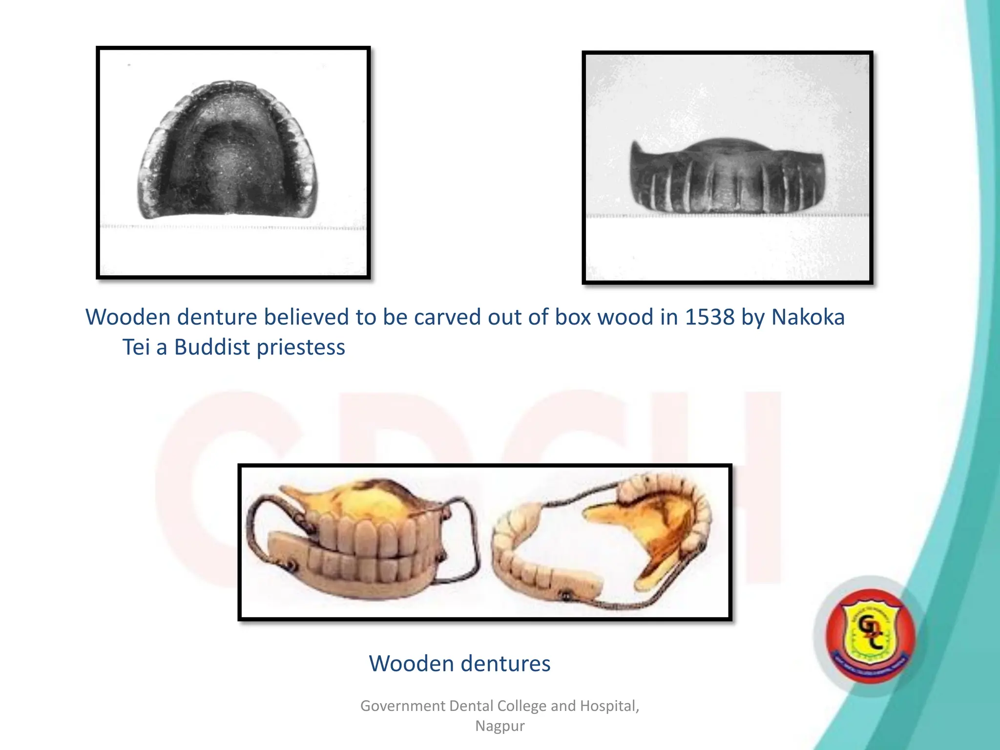 7.1-Classification-of-Denture-Base-Materials-History-Development-of ...