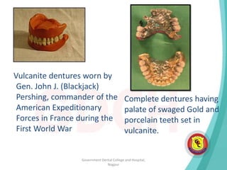 7.1-Classification-of-Denture-Base-Materials-History-Development-of ...