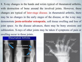 7.romatoied arthritis RA 2025.pdf