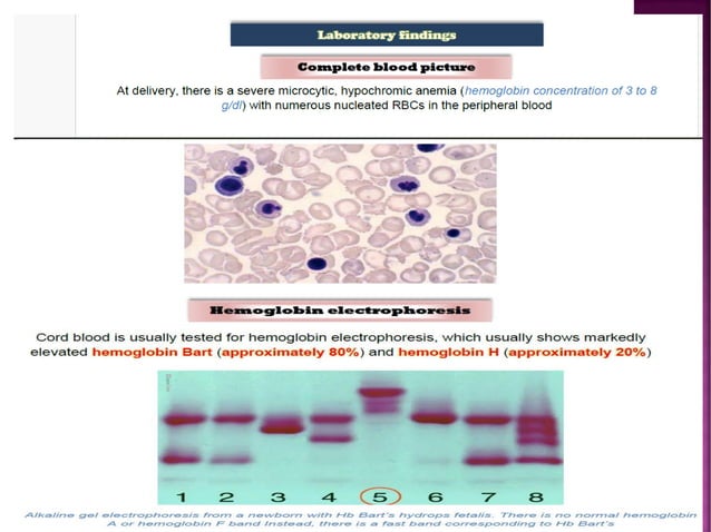 Hemoglobinopathies/Thalassaemias- Alphaa | PPT