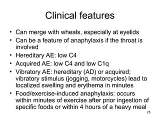 7. URTICARIA-1.ppt dermatology internal medicine | PPT