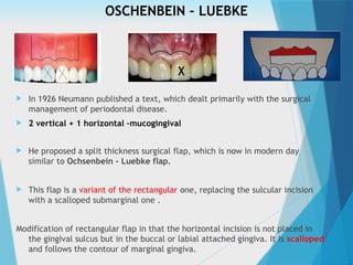 Various Flap Designs in Endodontic Surgery | PPTX