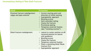 Tibial shaft fractures Managing soft tissues and infection | PPTX