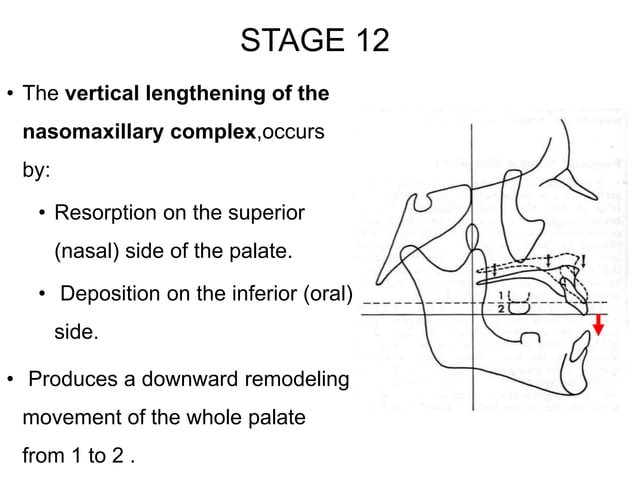 enlow counterpart principle with reference articles | PPTX | Bone and ...
