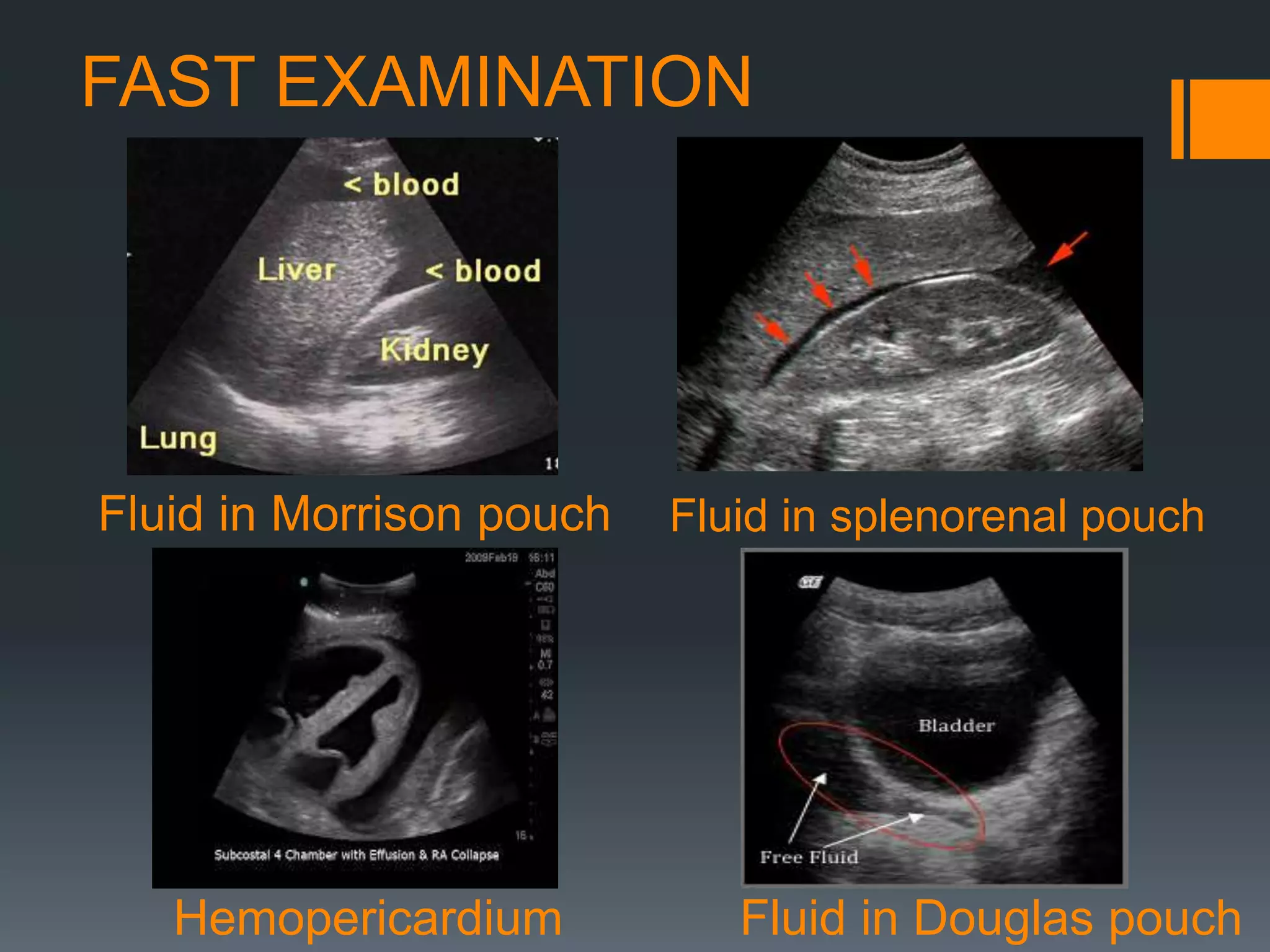 7- Abdominal trauma 1 | PPTX