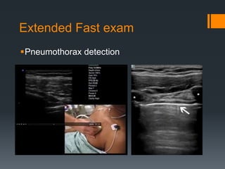 7- Abdominal trauma 1 | PPT