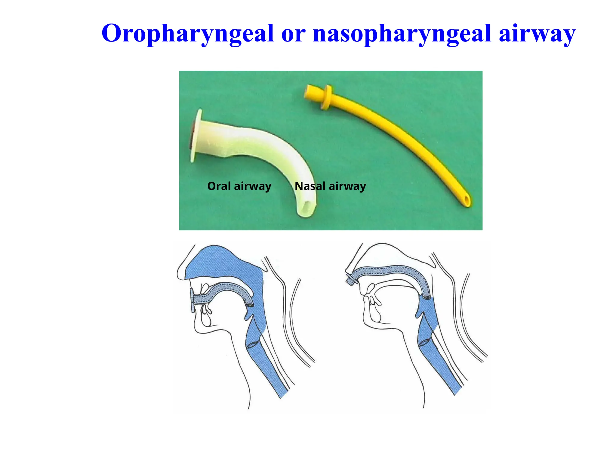 7-Airway & breathing manaaaajkjkjkgement.ppt