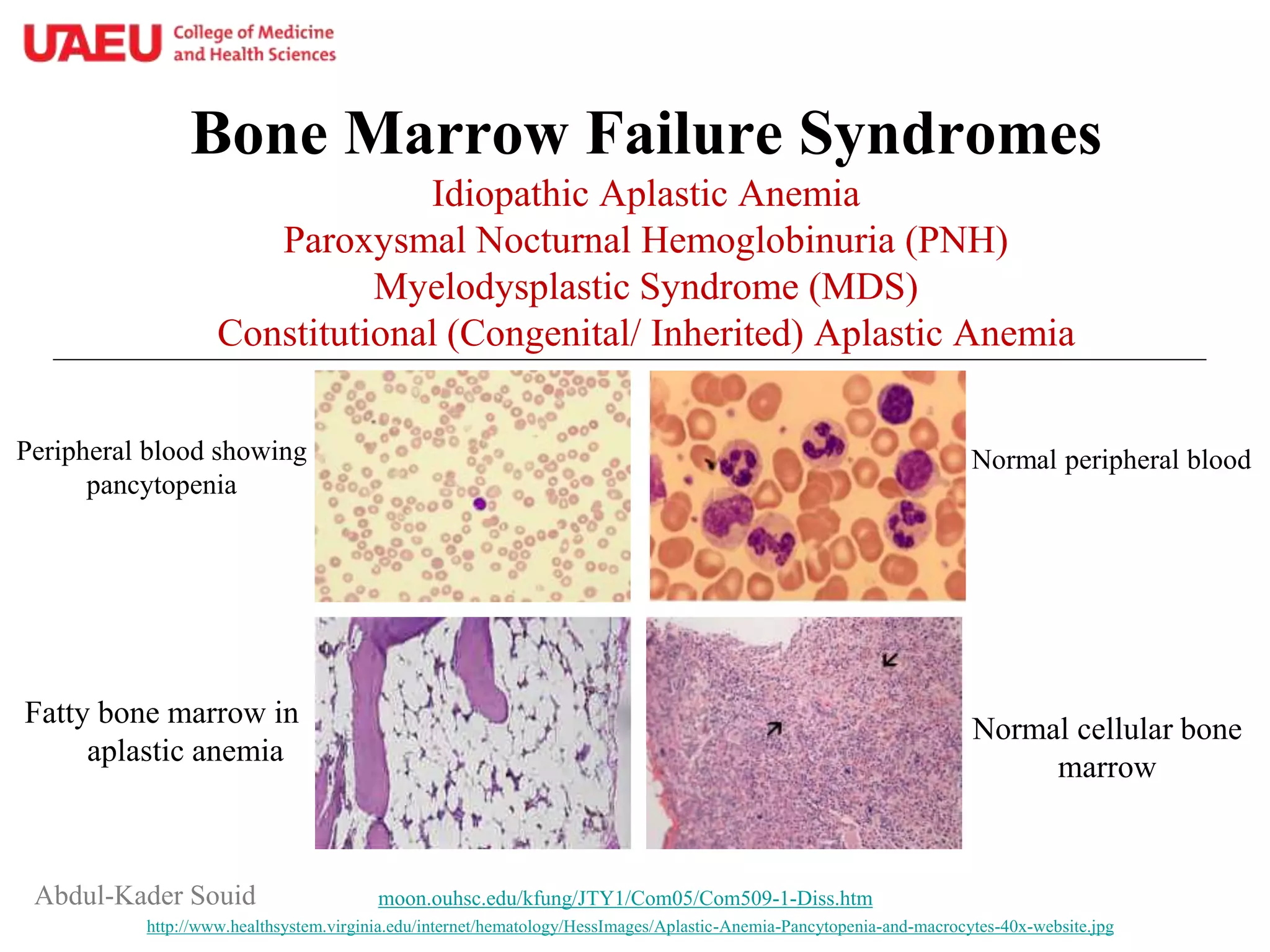 Bone marrow failure syndromes.ppt