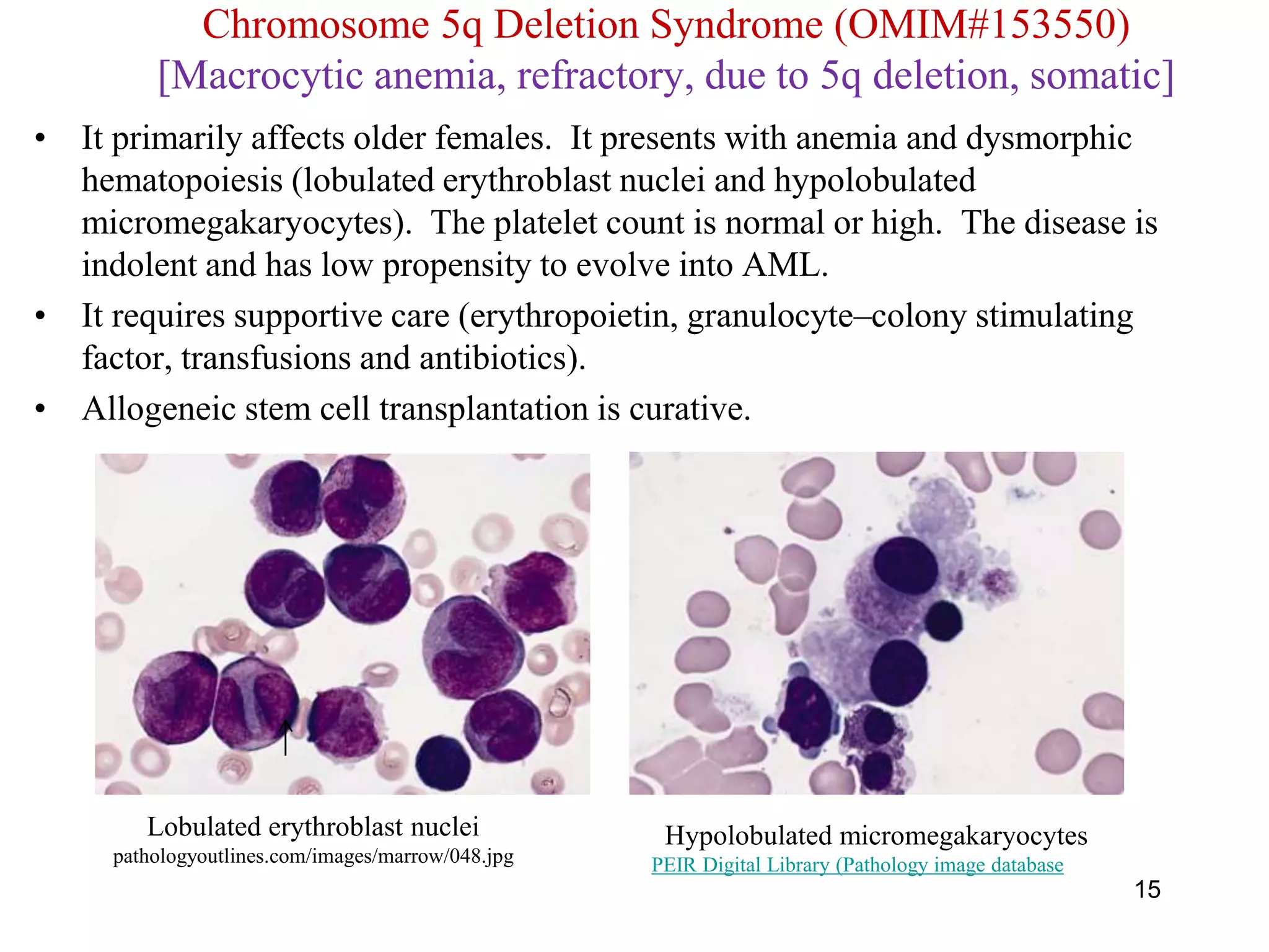 Bone marrow failure syndromes.ppt