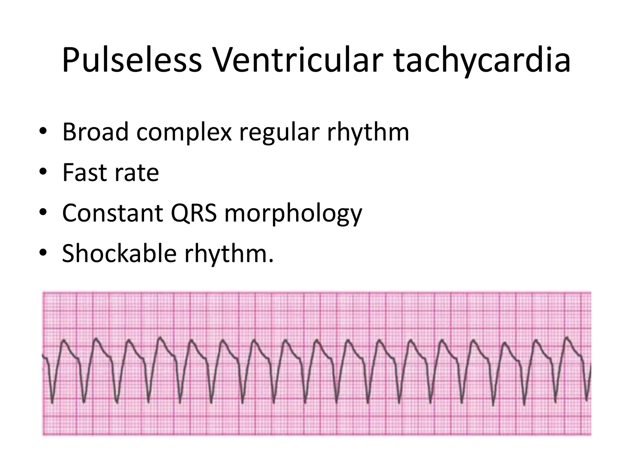 7-Cardiac_arrest(1).pptx