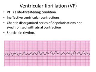 7-Cardiac_arrest(1).pptx