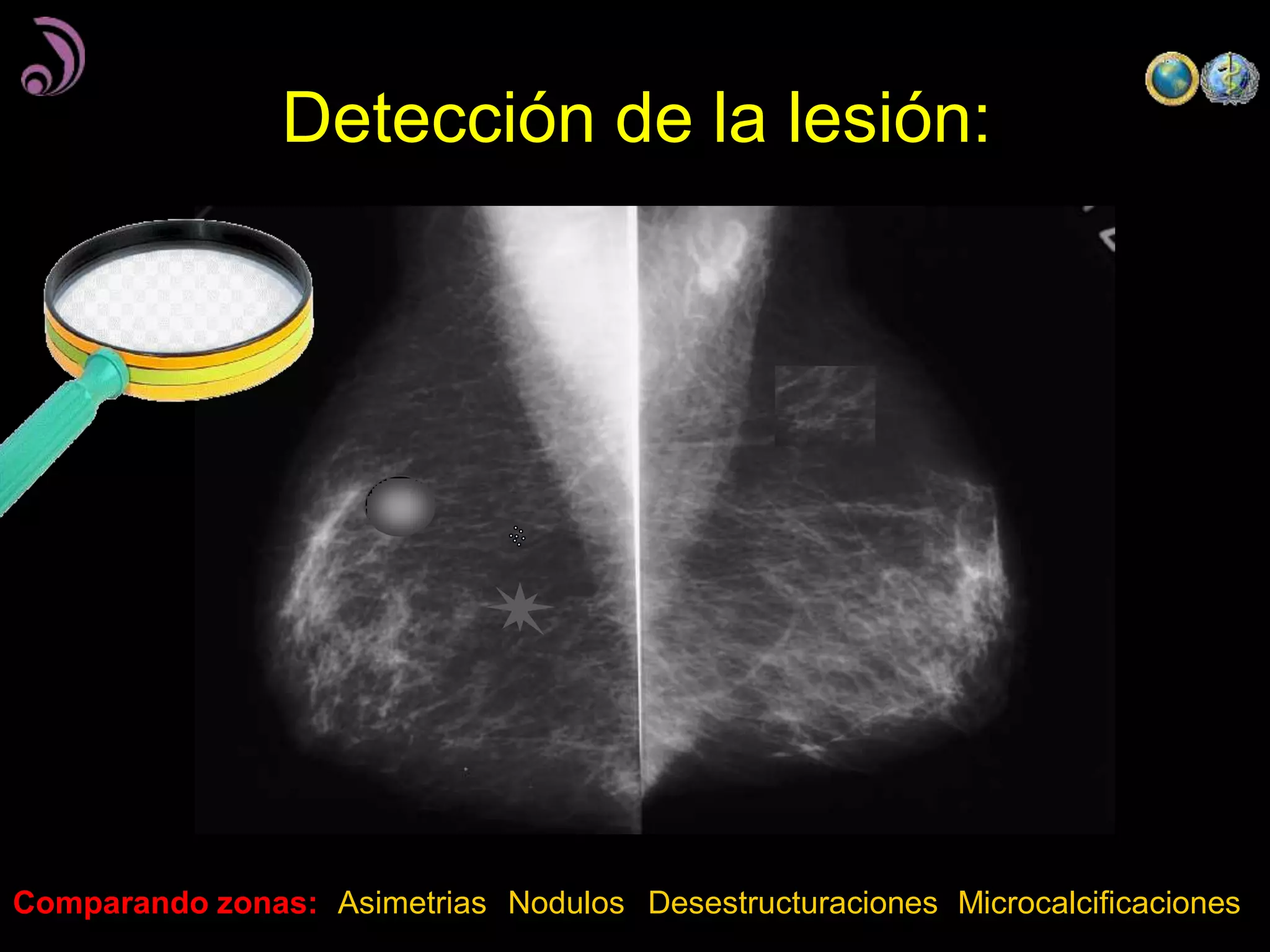 7 categorizacion practica-de_bi_rads_mysler | PDF | Medical Tests ...