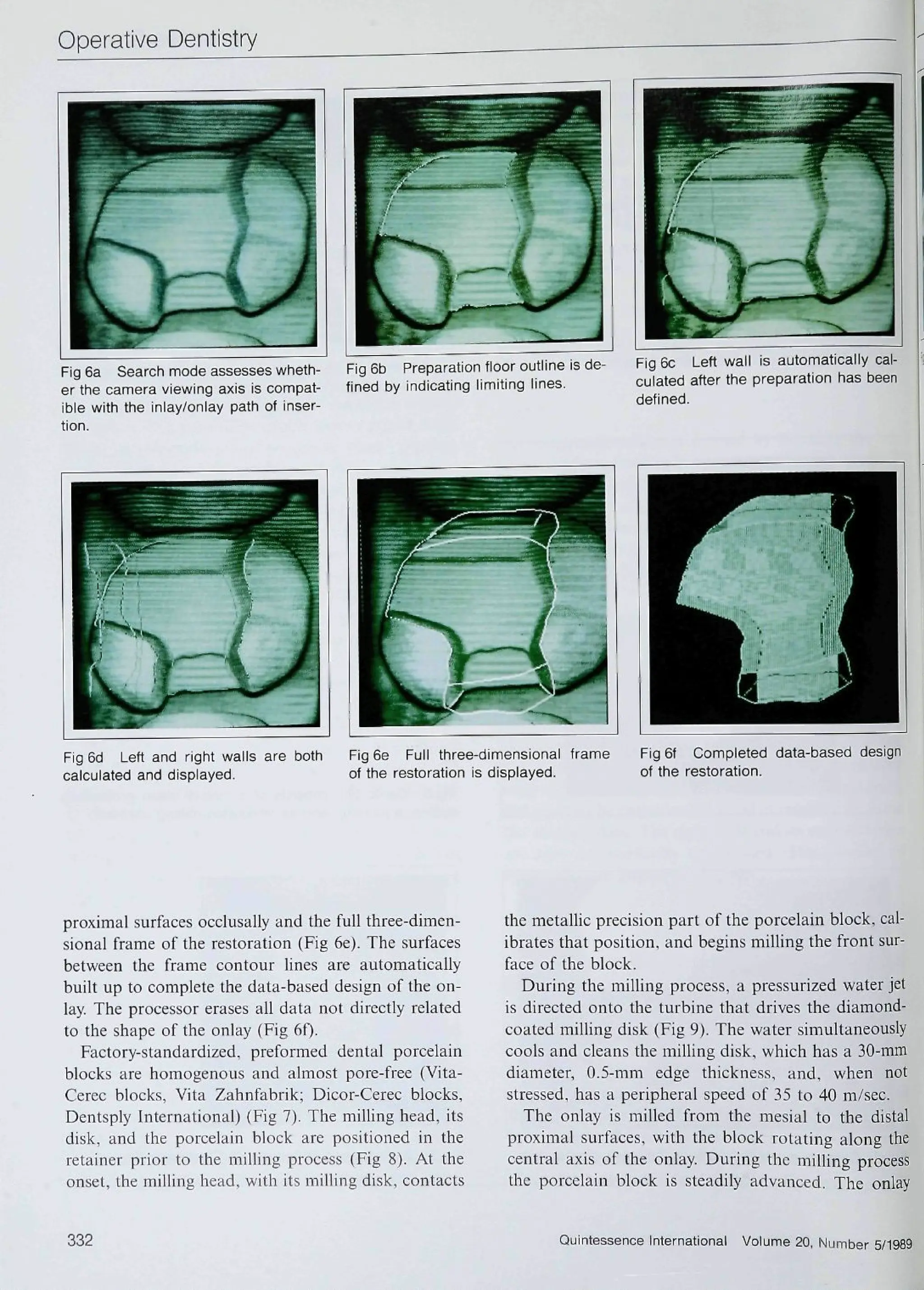 7 - Chairside computer-aided direct ceramic inlays.pdf