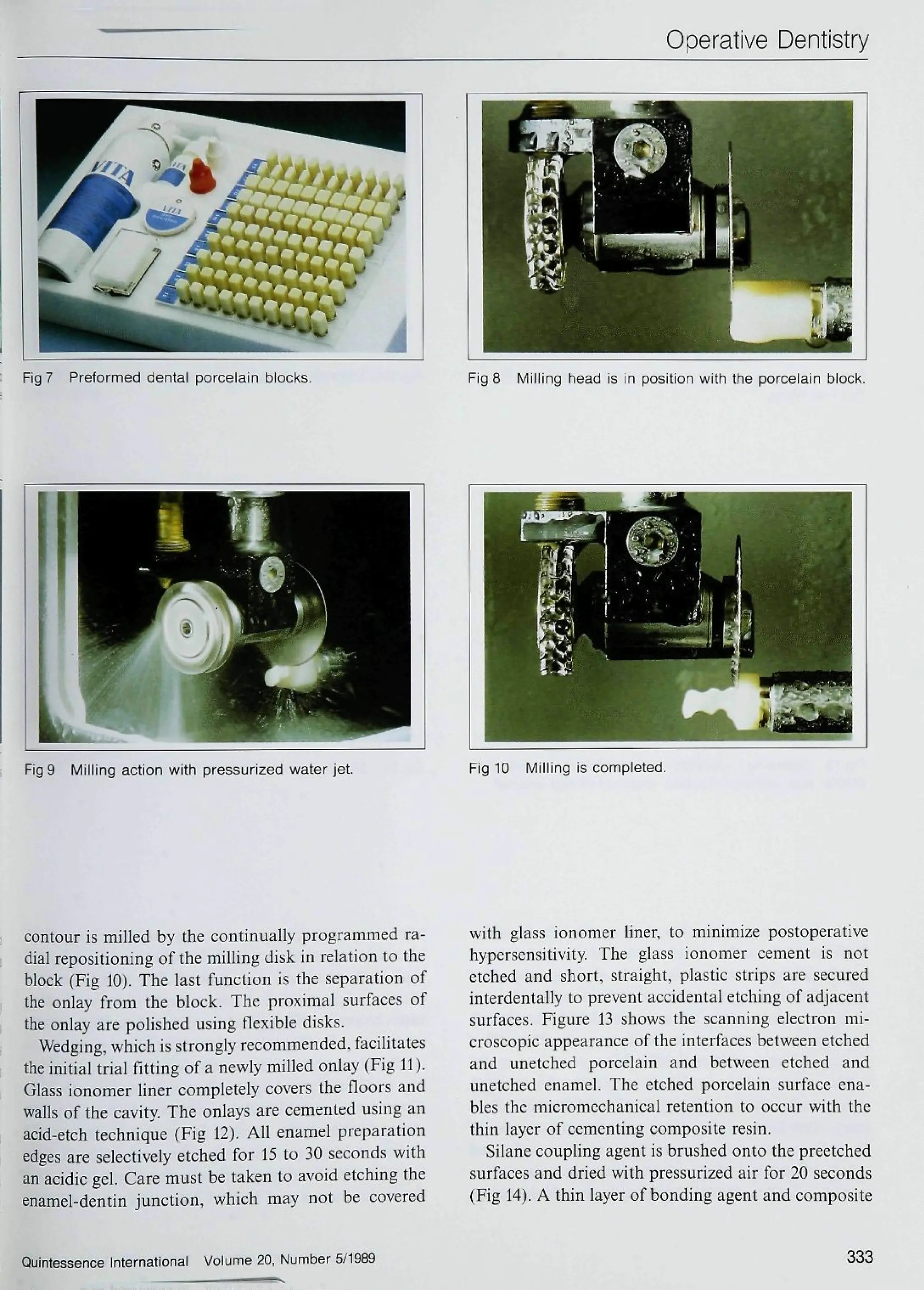 7 - Chairside computer-aided direct ceramic inlays.pdf