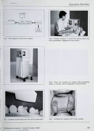 7 - Chairside computer-aided direct ceramic inlays.pdf