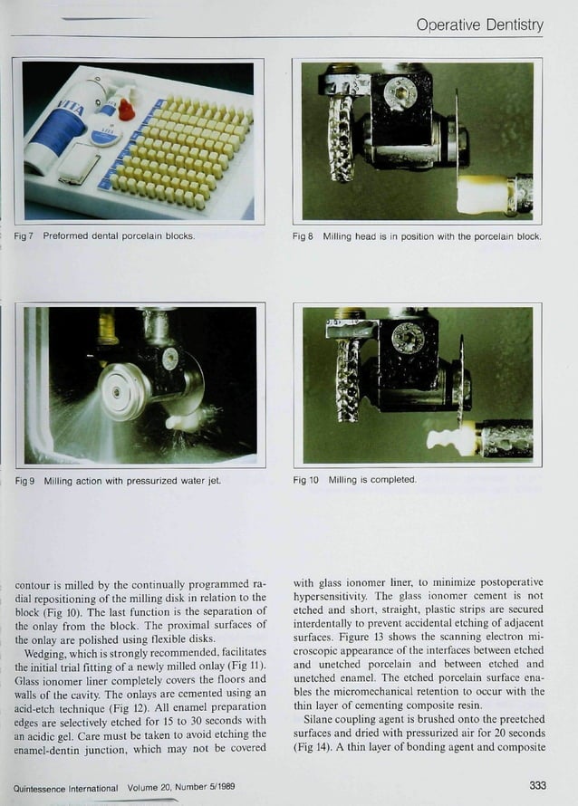 7 - Chairside computer-aided direct ceramic inlays.pdf