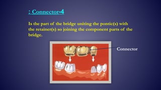7- Classification of fixed partial denture.pptx