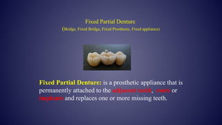 7- Classification of fixed partial denture.pptx