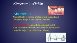 7- Classification of fixed partial denture.pptx