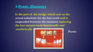 7- Classification of fixed partial denture.pptx