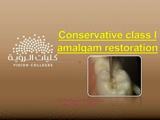 7- Class one amalgam cavity prep (1).pdf