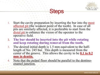 7- Class one amalgam cavity prep (1).pdf