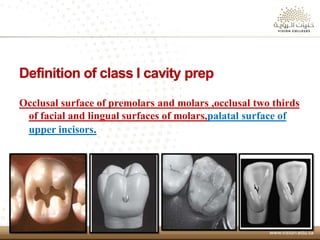 7- Class one amalgam cavity prep (1).pdf
