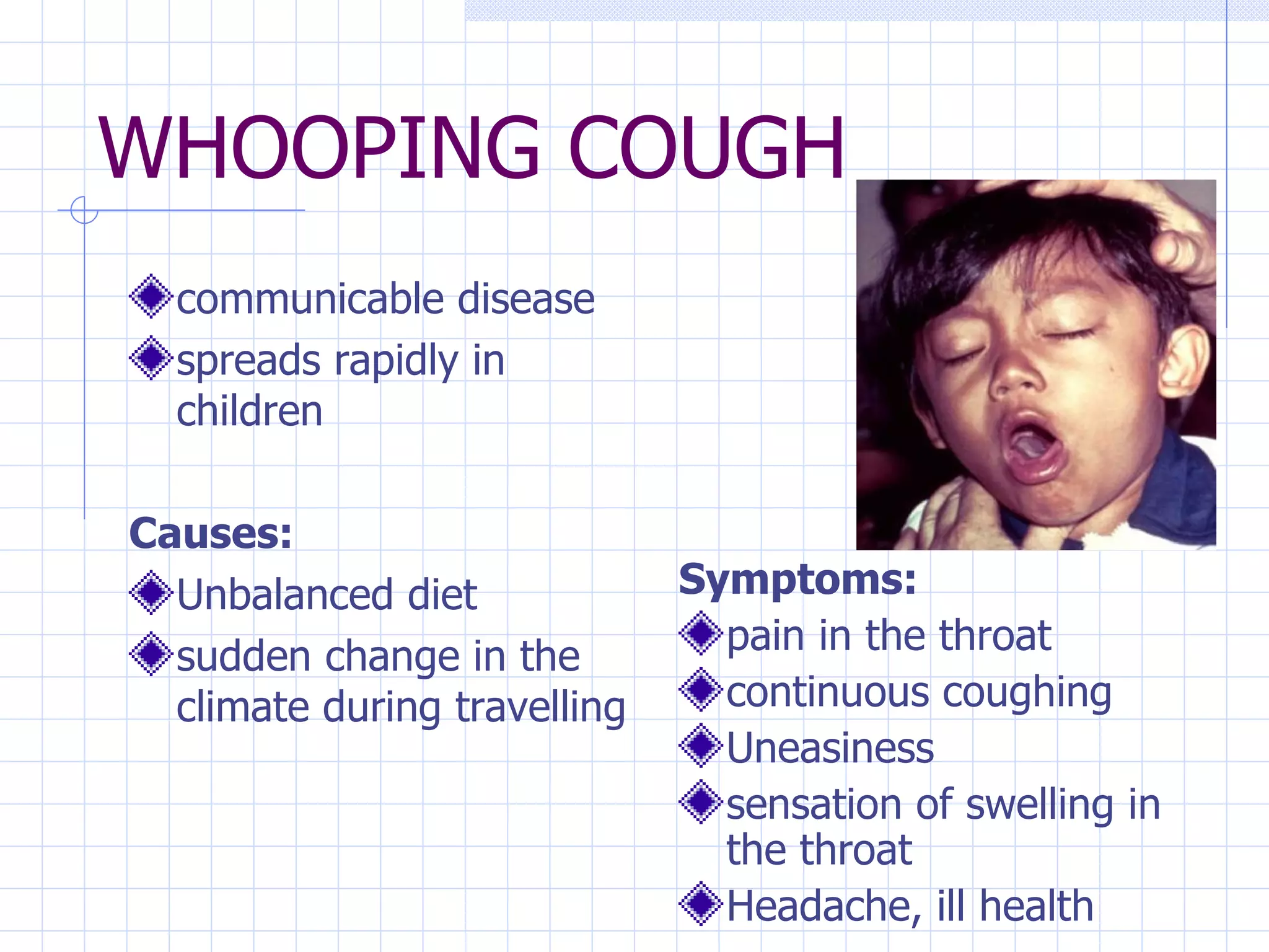 7. common diseases in children | PPT