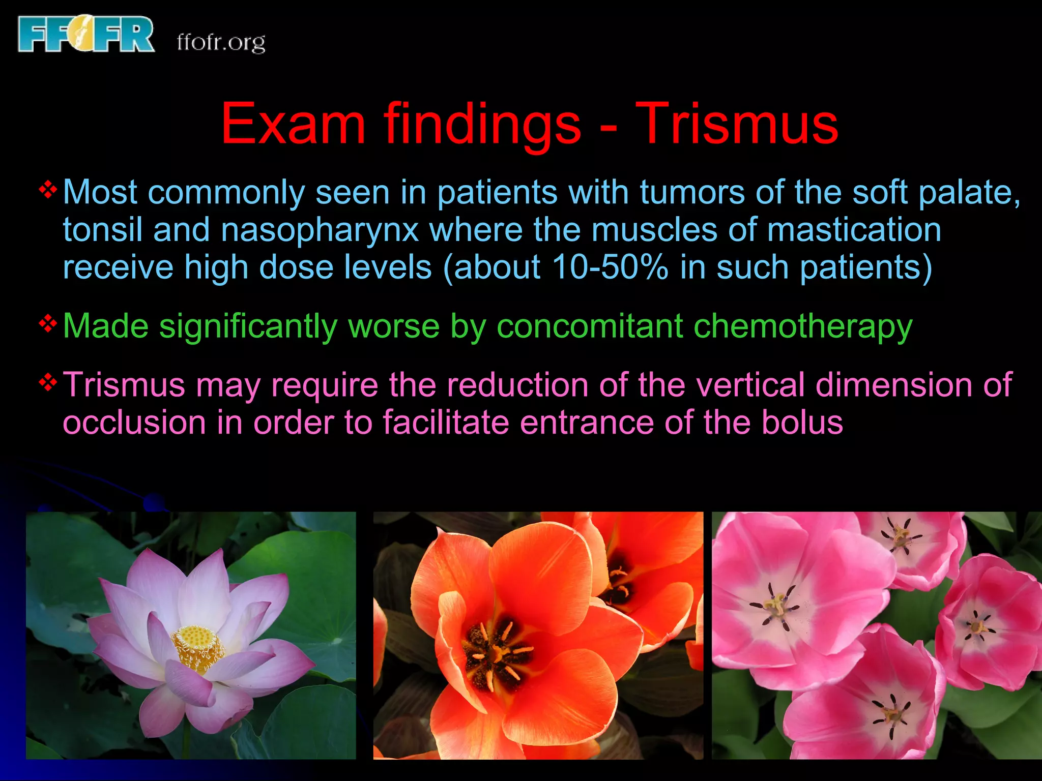 Complete Dentures for Irradiated Patients | PPT