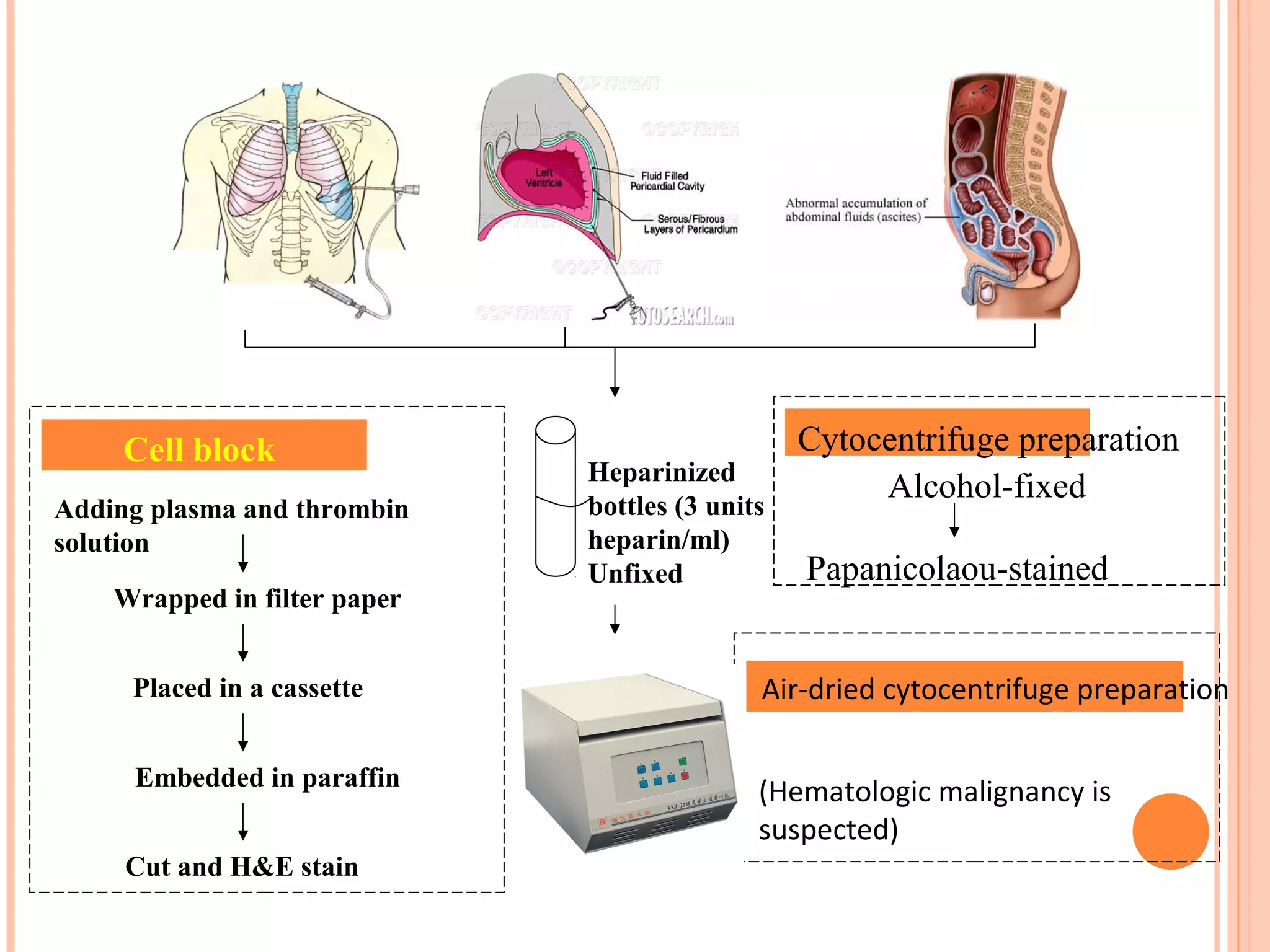 cytology of body fluid | PPT