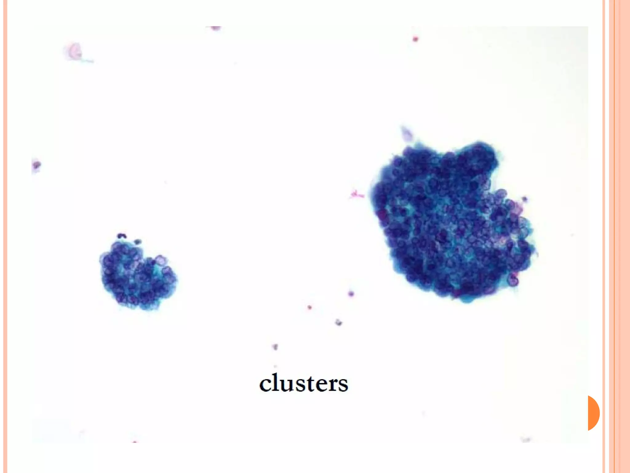 cytology of body fluid | PPT