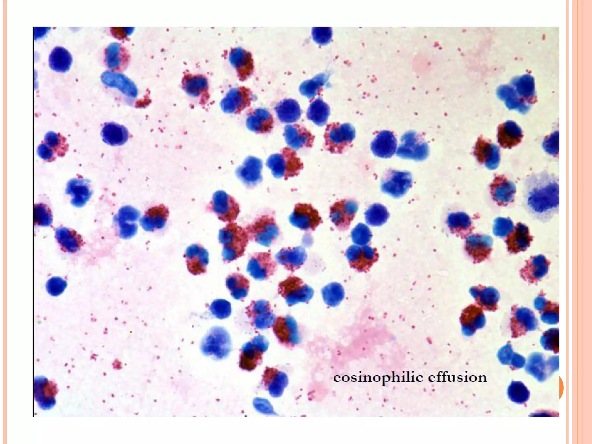 cytology of body fluid | PPT