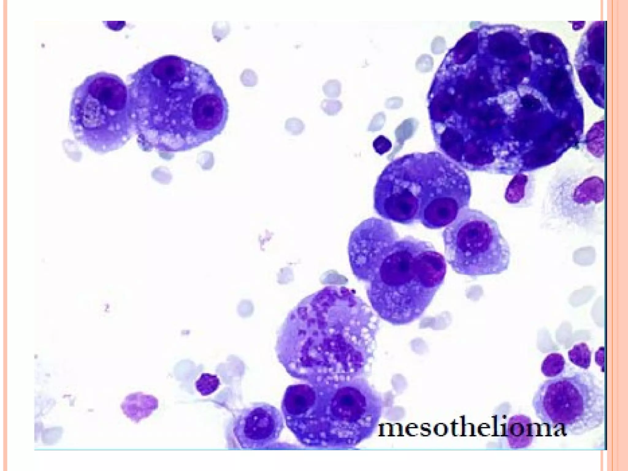 cytology of body fluid | PPT