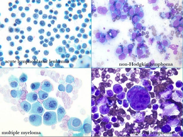 cytology of body fluid
