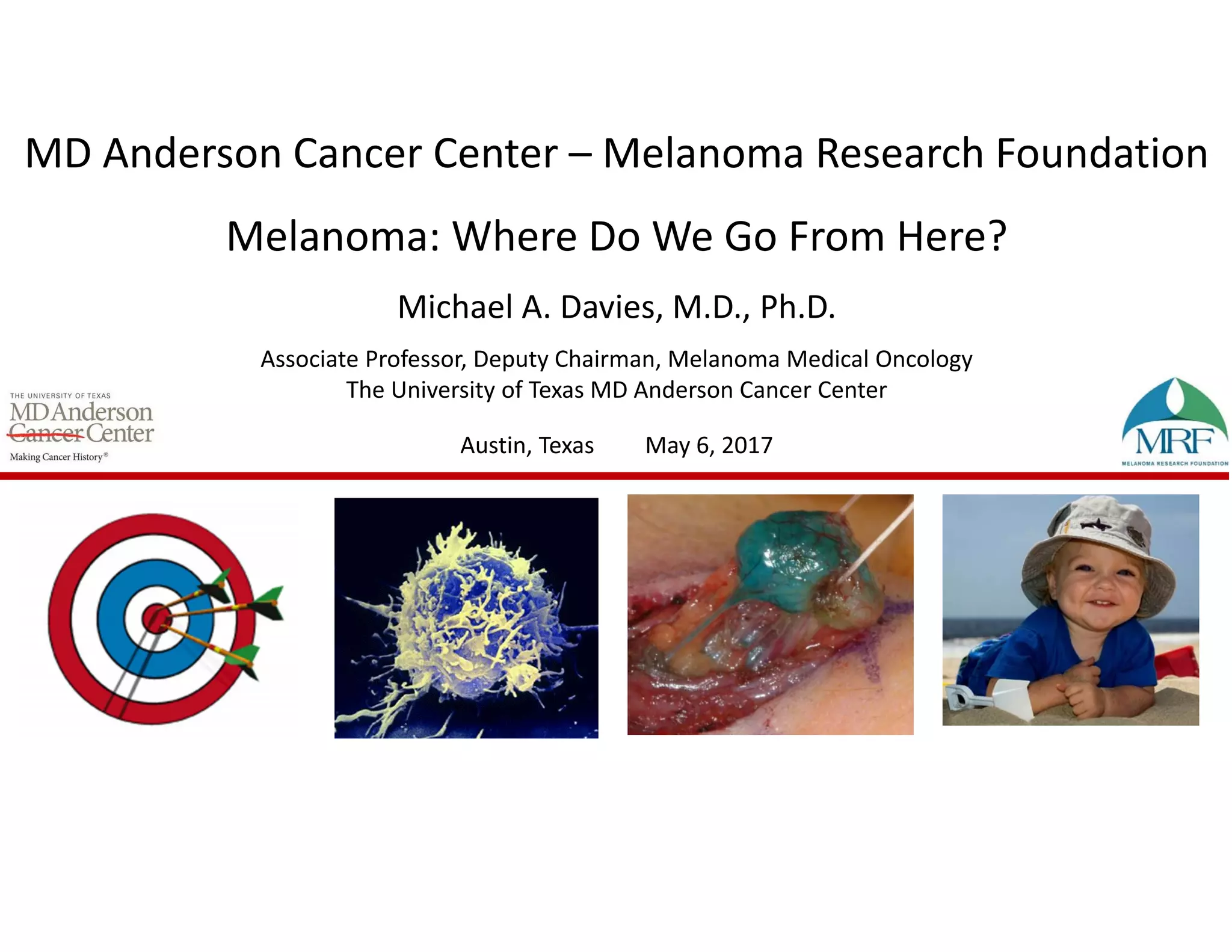 Melanoma: Where Do We Go from Here? – Michael A. Davies, MD, PhD | PDF