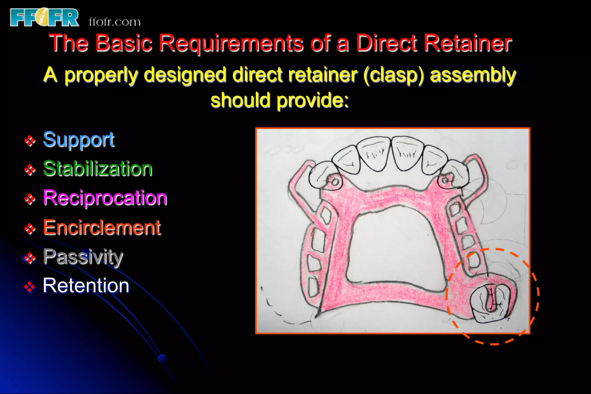 7.designing rpd's, planning sequence for rpd patients | PDF