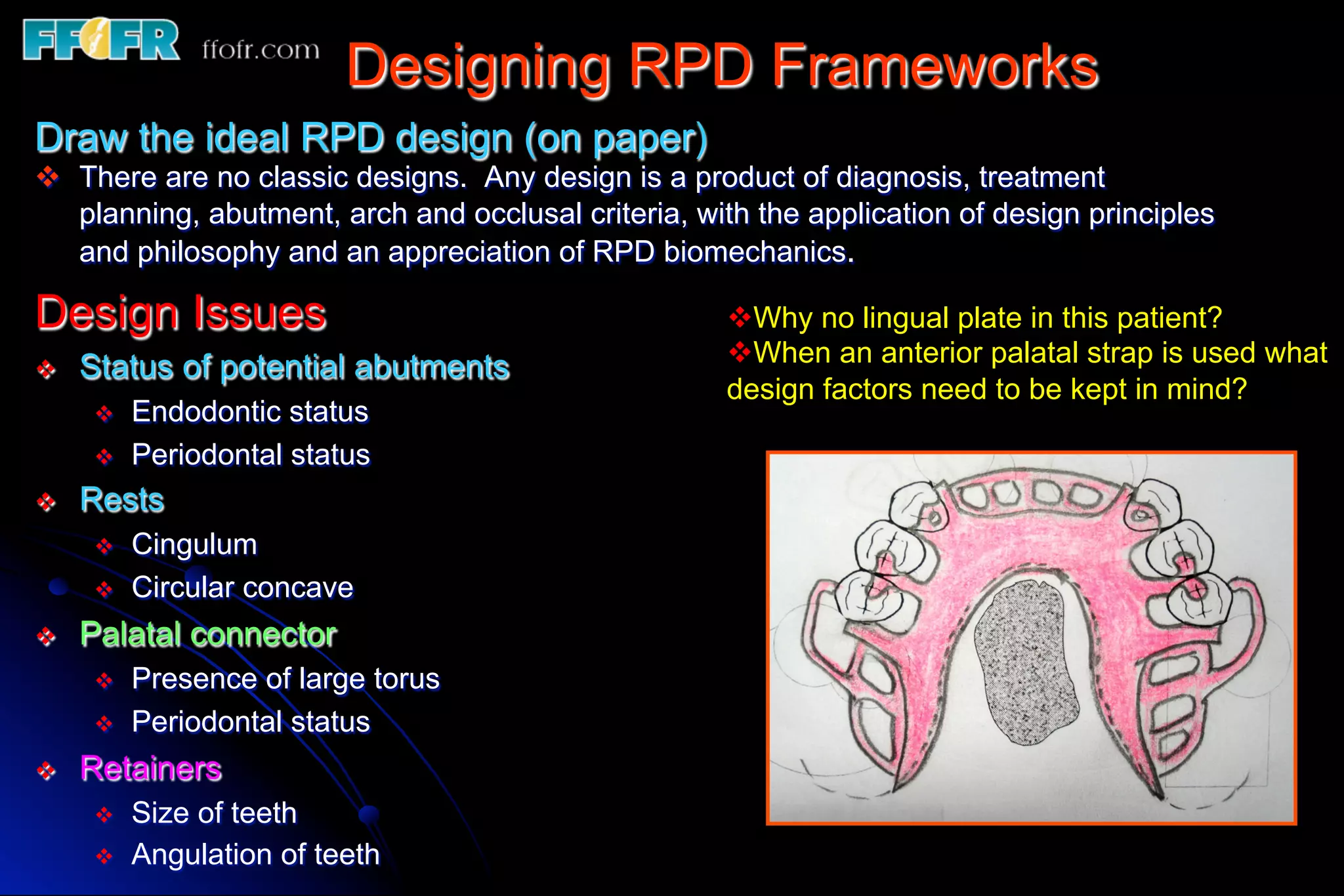 7.designing rpd's, planning sequence for rpd patients | PDF