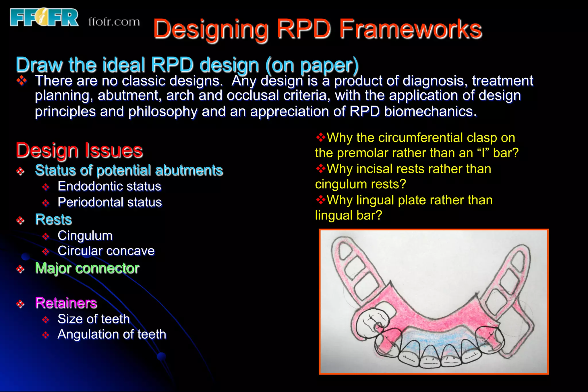 7.designing rpd's, planning sequence for rpd patients | PDF