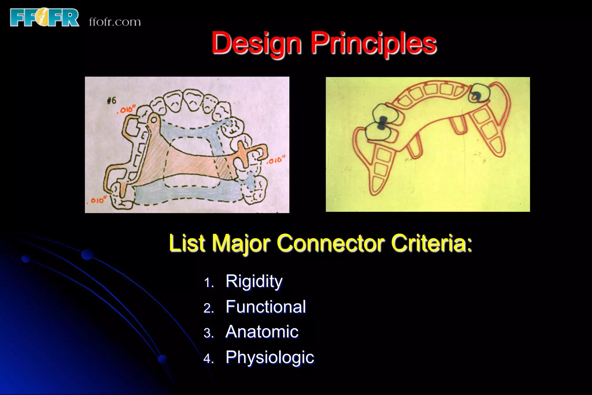 7.designing rpd's, planning sequence for rpd patients | PDF